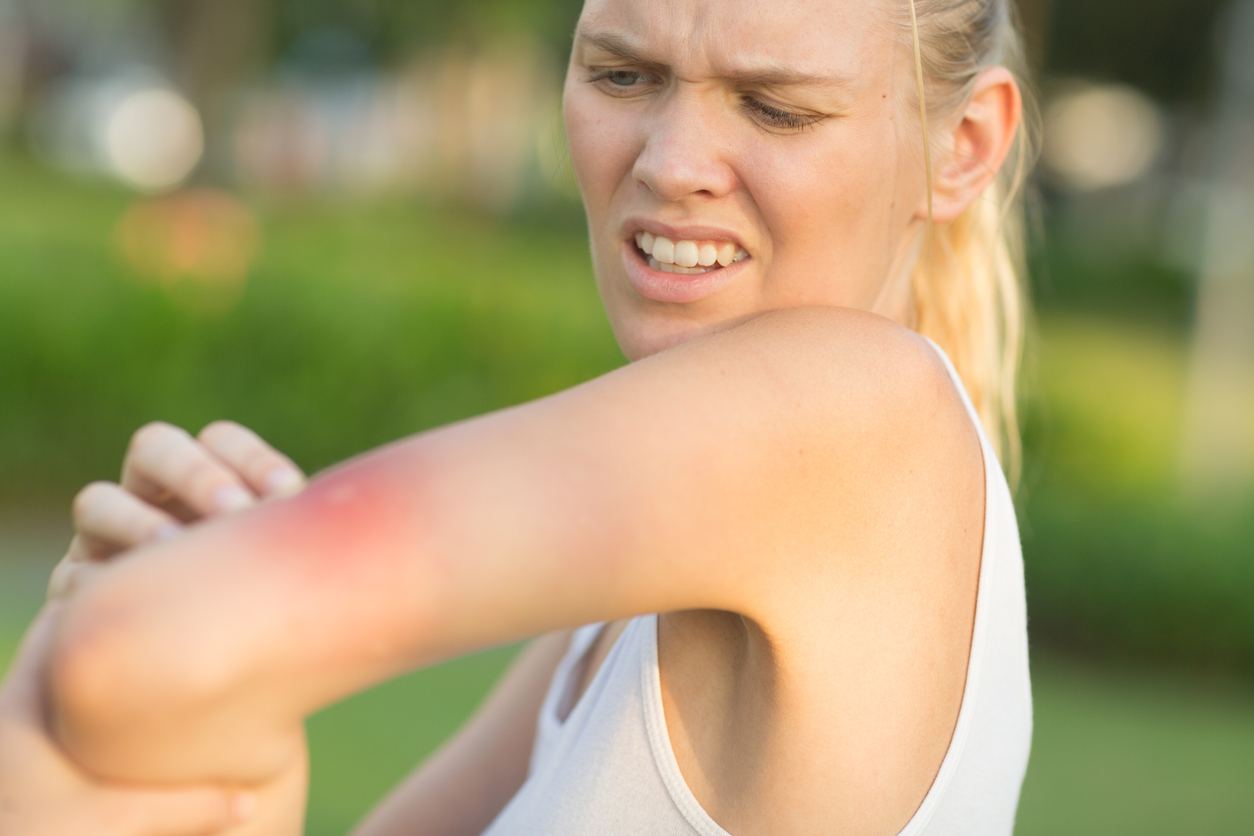 How do you treat an insect sting allergy? | Oak Brook Allergists